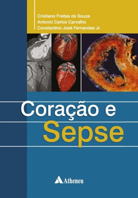 Coração e Sepse