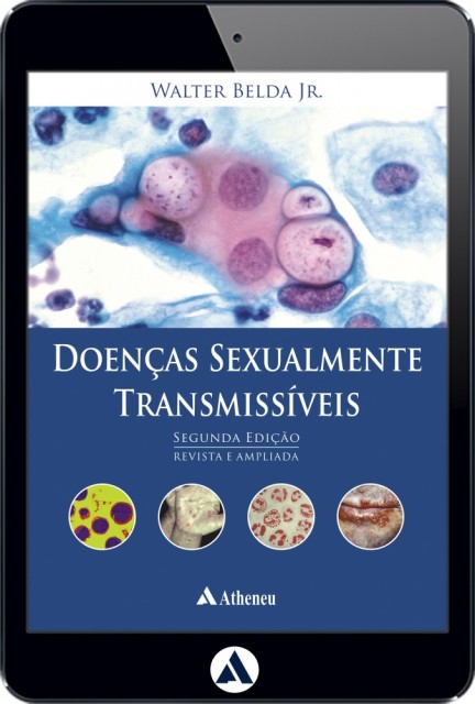 O Que Sao Doencas Sexualmente Transmissiveis
