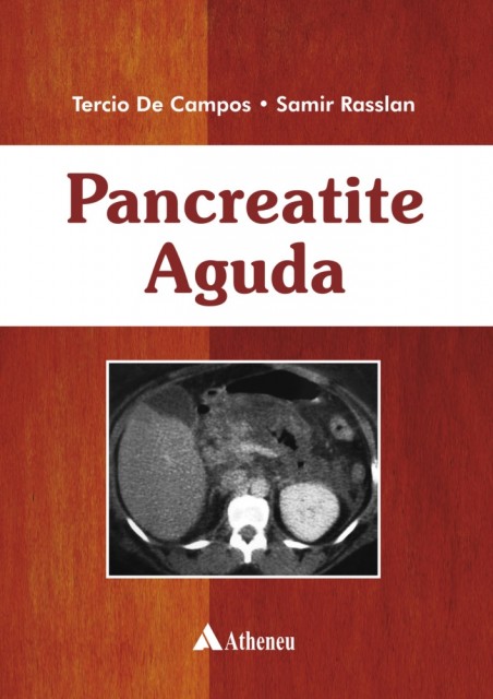 Pancreatite Aguda
