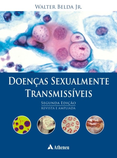 Doenças Sexualmente Transmissíveis - 2ª Edição